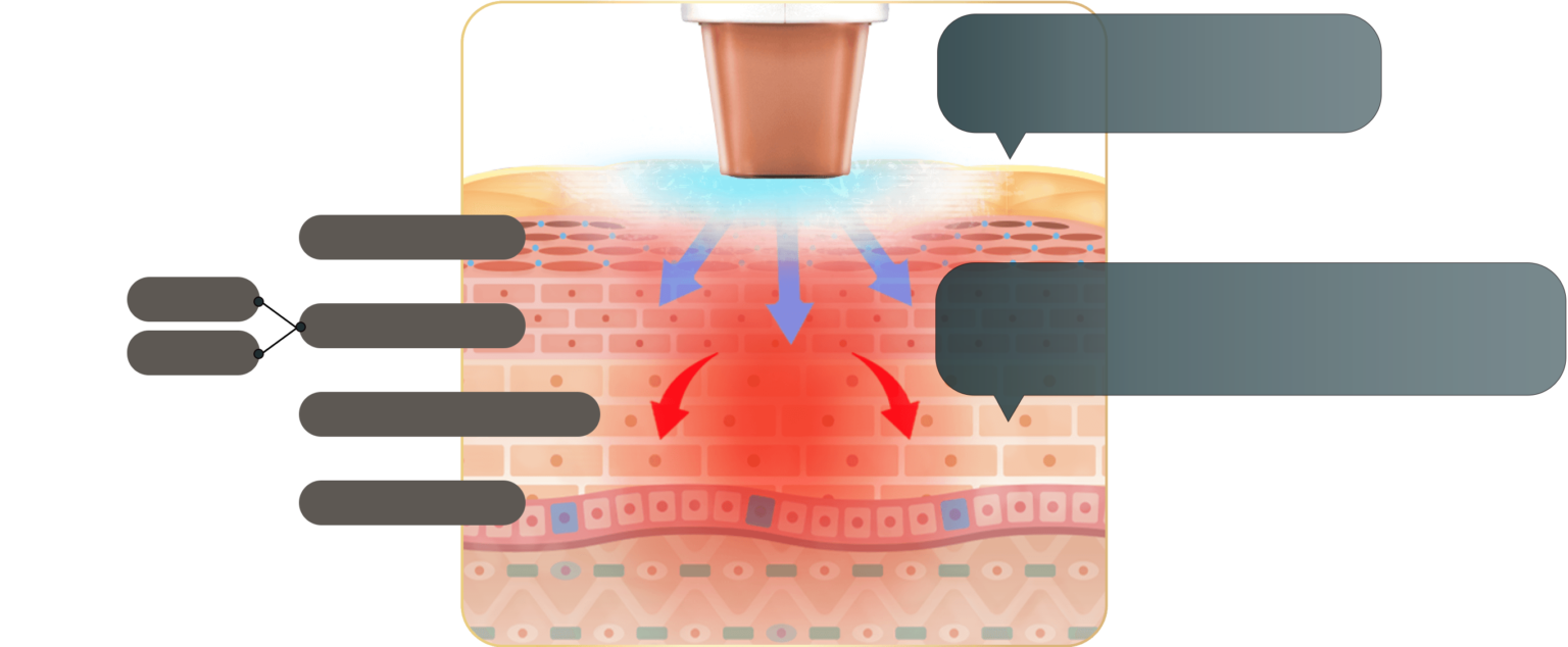 density – Jeisys Global