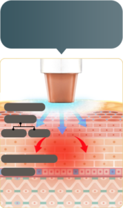 density – Jeisys Global